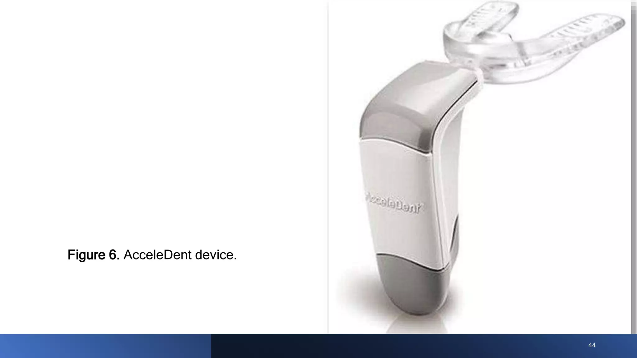 Accelerated orthodontics.pptx | Bone and Joint Conditions | Diseases and Conditions