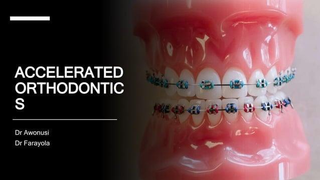 Accelerated orthodontics.pptx