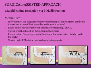 Accelerated orthodontic tooth movement | PPTX