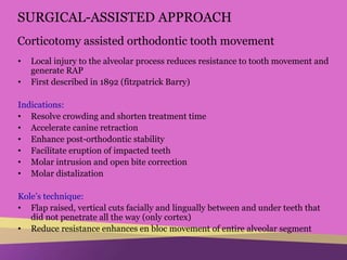 Accelerated orthodontic tooth movement | PPTX
