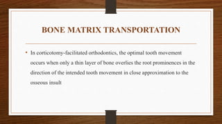 Accelerated Osteogenic Orthodontics Technique.pptx