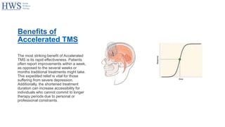 Accelerated TMS Moving Quickly into the Future of Depression Treatment ...