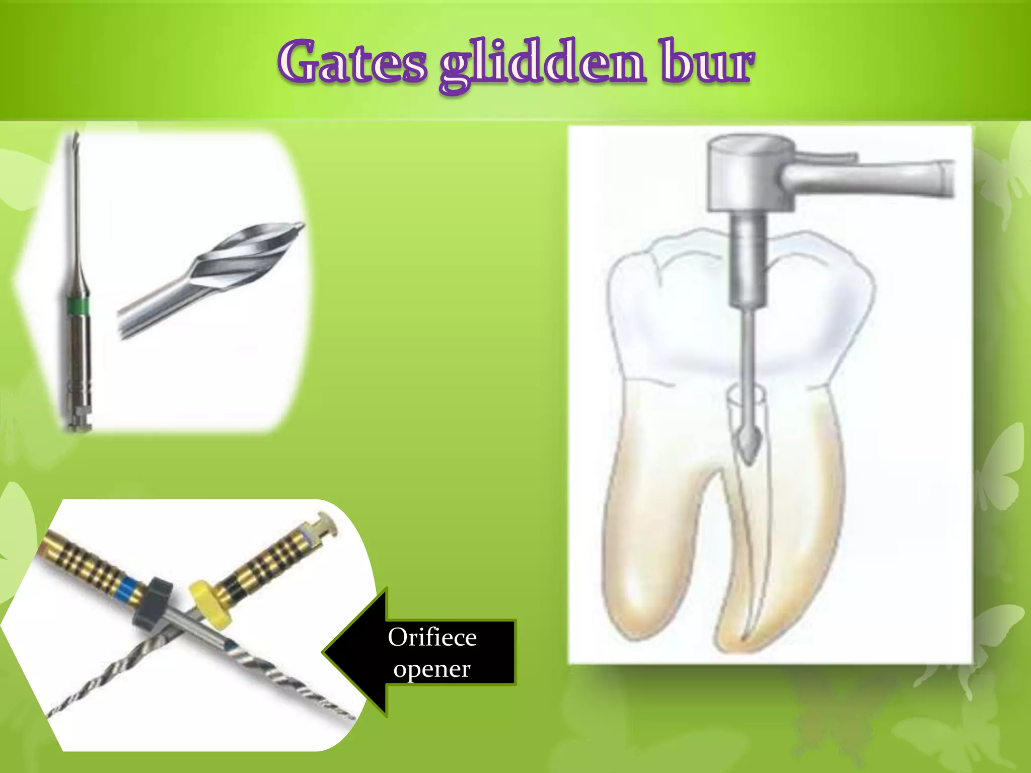 Acces opening of anterior and premolar teeth(shadan) | PPTX