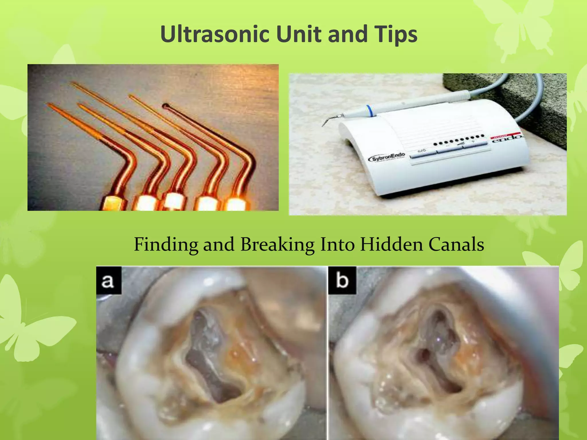 Acces opening of anterior and premolar teeth(shadan) | PPTX