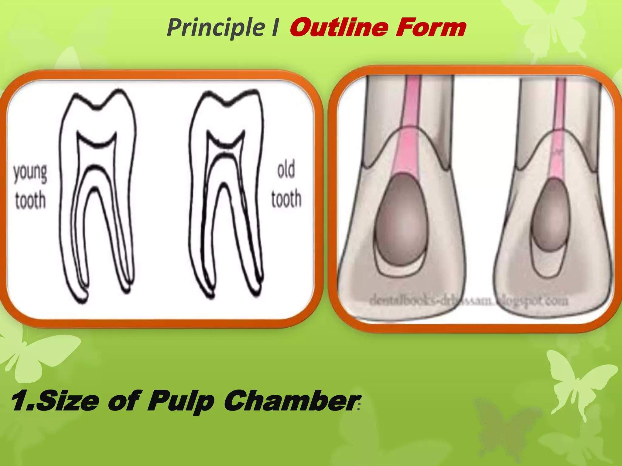 Acces opening of anterior and premolar teeth(shadan) | PPTX