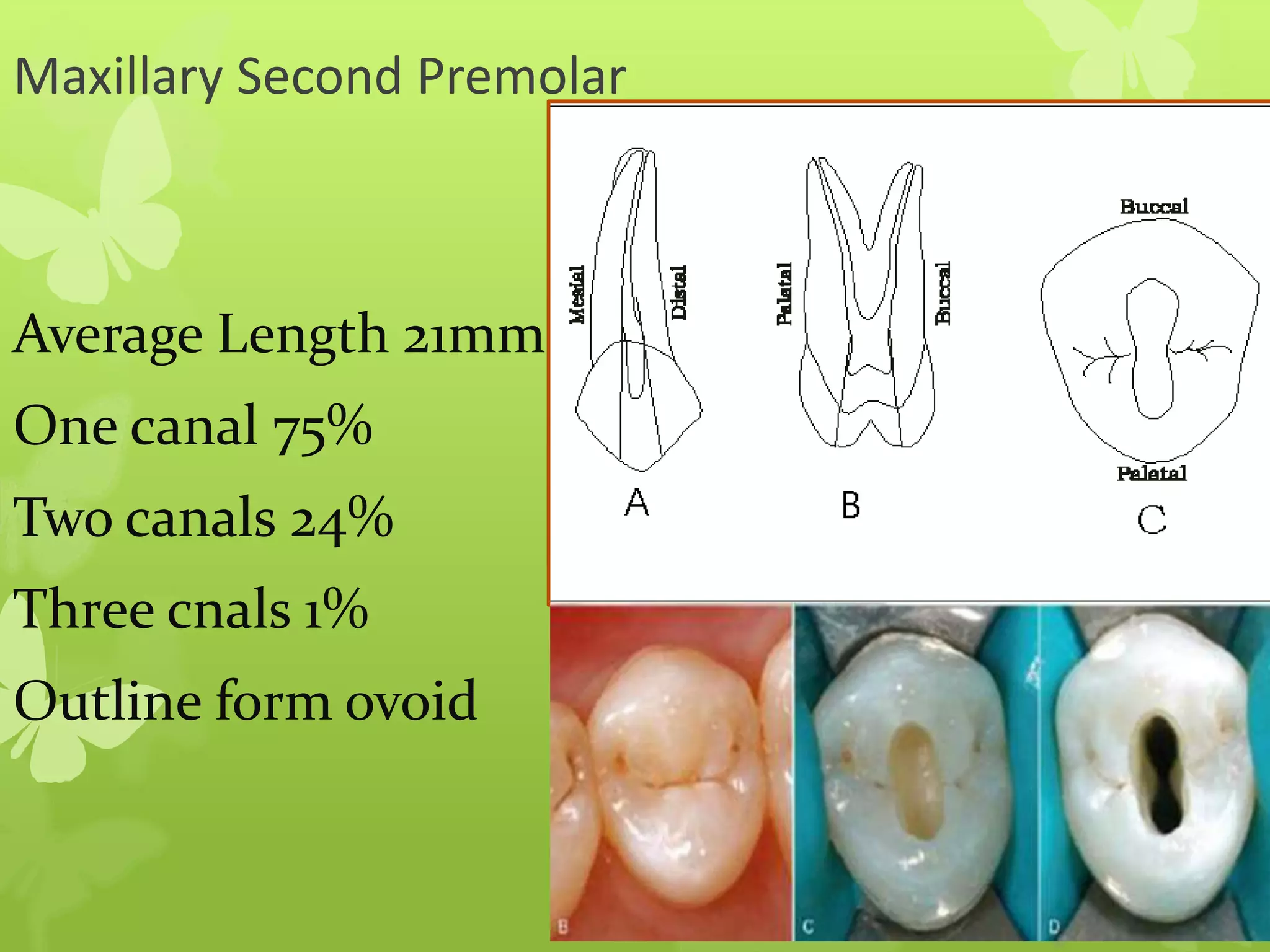 Acces opening of anterior and premolar teeth(shadan) | PPTX