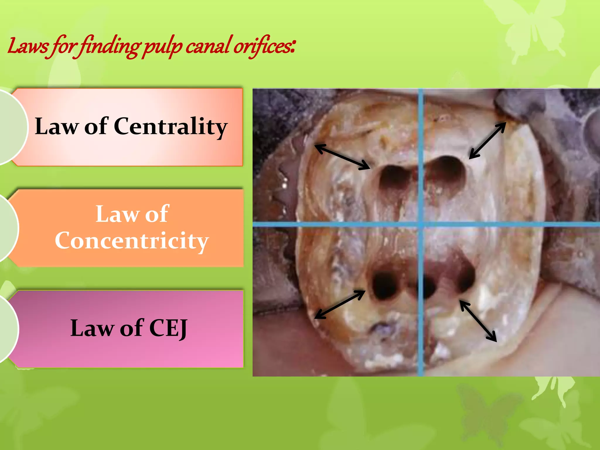 Acces opening of anterior and premolar teeth(shadan) | PPTX
