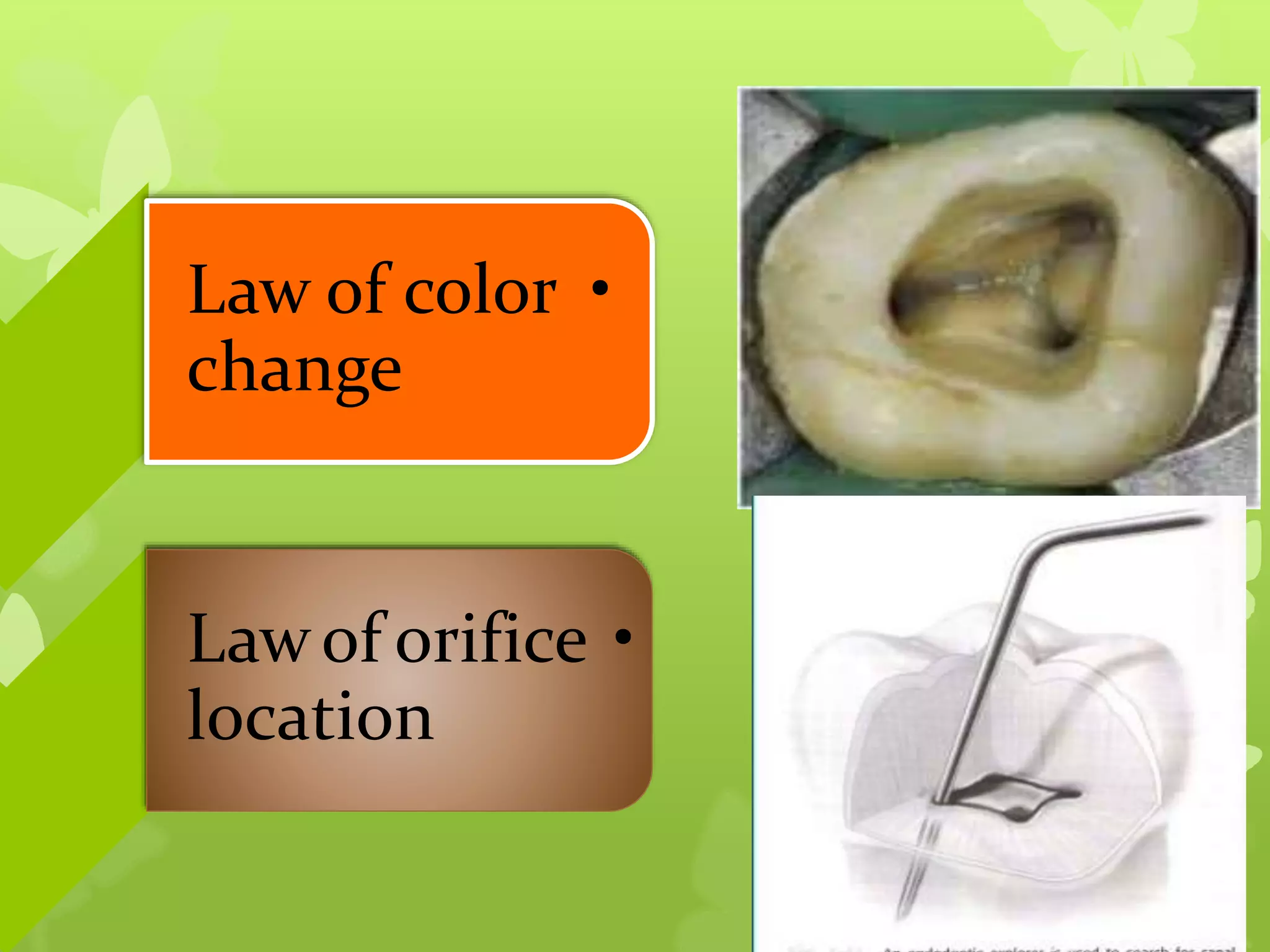 Acces opening of anterior and premolar teeth(shadan) | PPTX