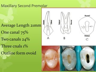 Acces opening of anterior and premolar teeth(shadan) | PPT