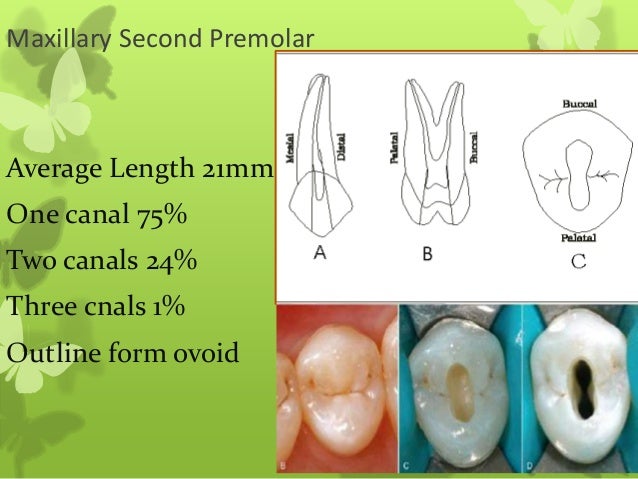 Acces opening of anterior and premolar teeth(shadan)