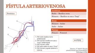 Accesos Vasculares | PPTX