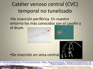 Accesos vasculares en urgencias | PPTX
