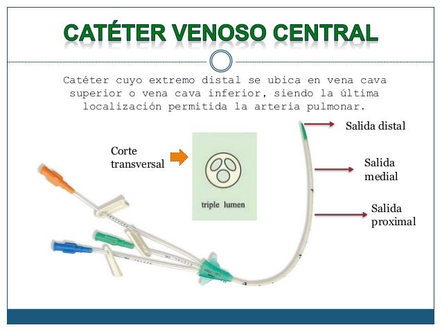 Accesos venosos