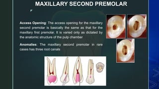 Access opening | PPTX