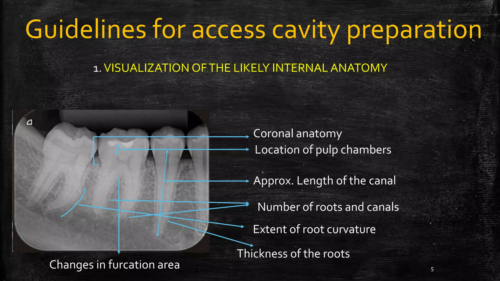 Access cavity prepration | PPTX