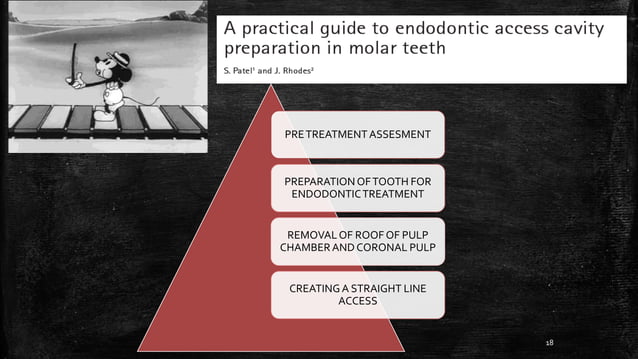 Access cavity prepration | PPTX | Dental Health | Diseases and Conditions