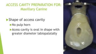 access cavity preparation in upper and lower teeth. pdf | PPT