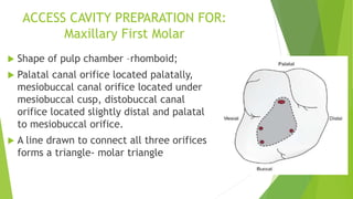 access cavity preparation in upper and lower teeth. pdf | PPT