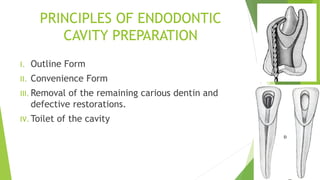 access cavity preparation in upper and lower teeth. pdf | PPT