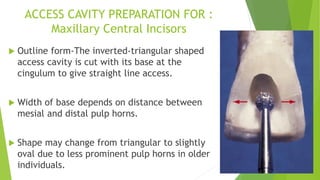 access cavity preparation in upper and lower teeth. pdf | PPT
