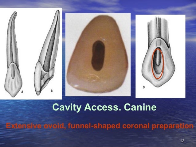 Access cavity preparation