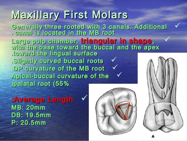 Access cavity preparation