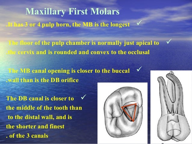 Access cavity preparation
