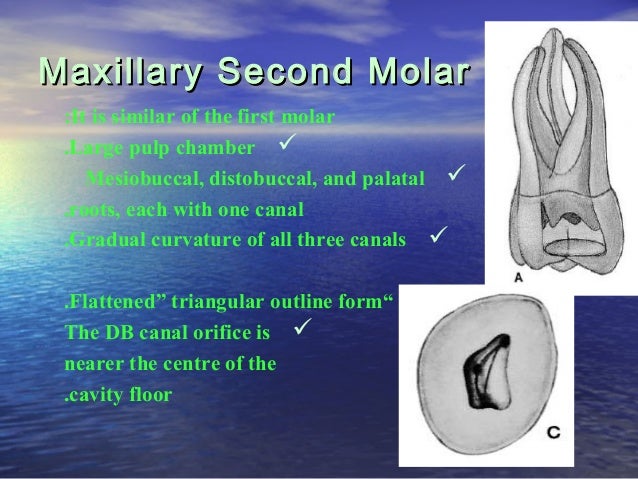 Access cavity preparation
