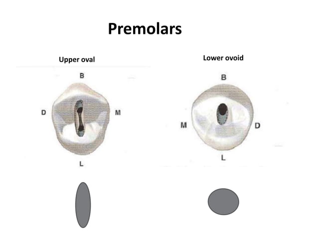 Access cavity preparation | PPTX