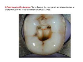 Access cavity preparation | PPTX