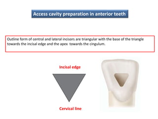 Access cavity preparation | PPT
