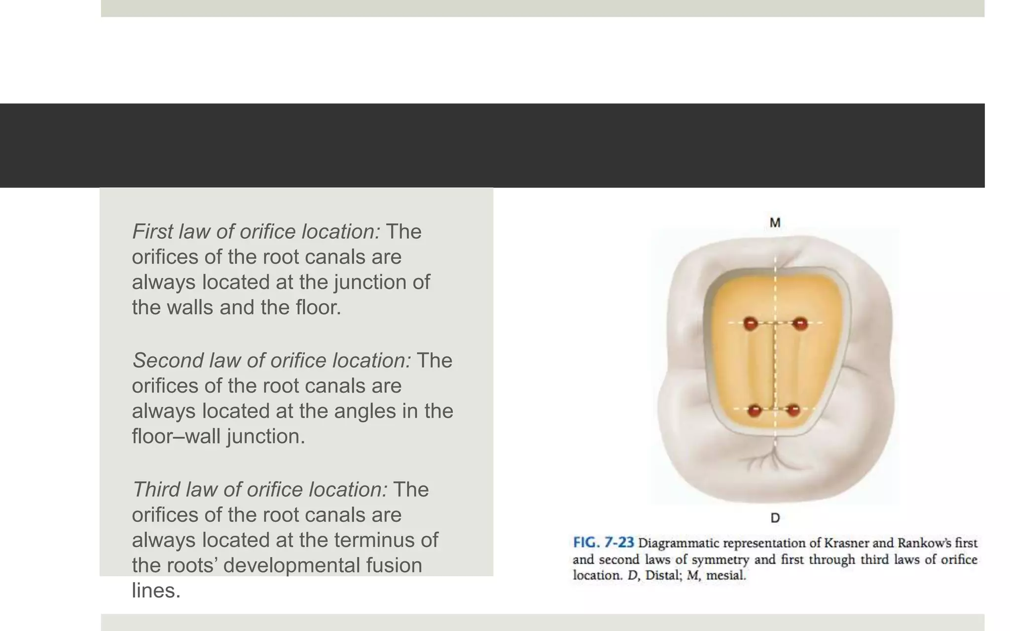 Access cavity preparation | PPTX