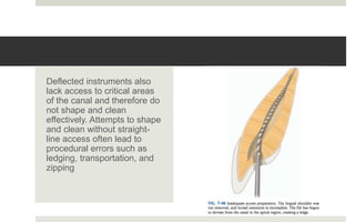 Access cavity preparation | PPTX