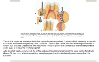Access cavity preparation | PPTX