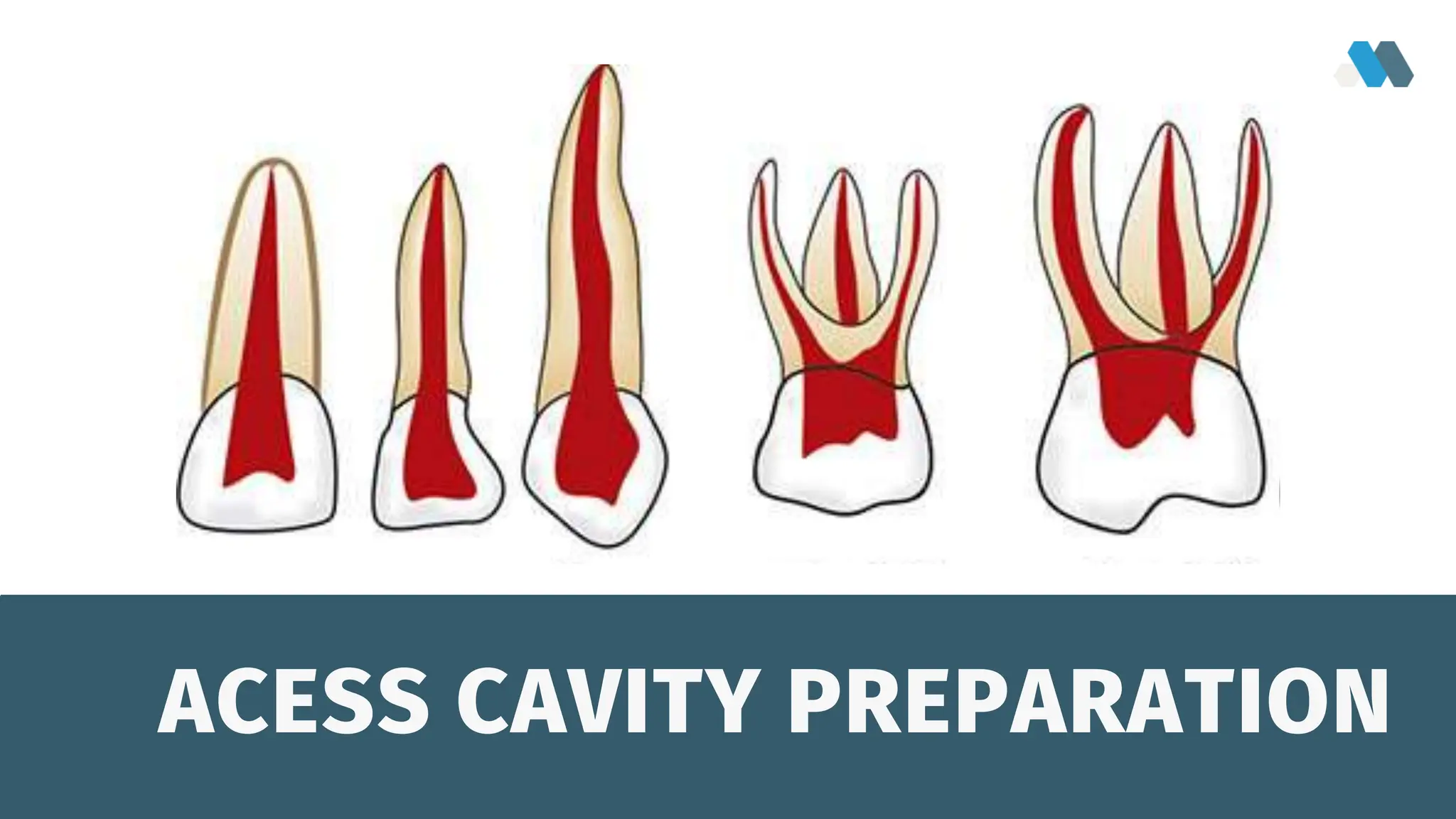 Principles of Access cavity preparation.pptx