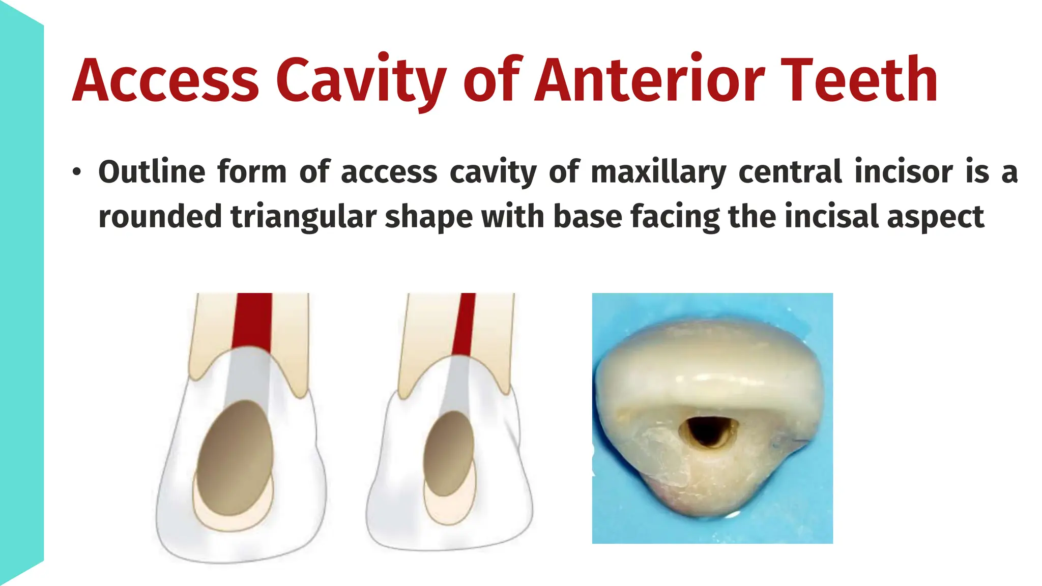 Principles of Access cavity preparation.pptx
