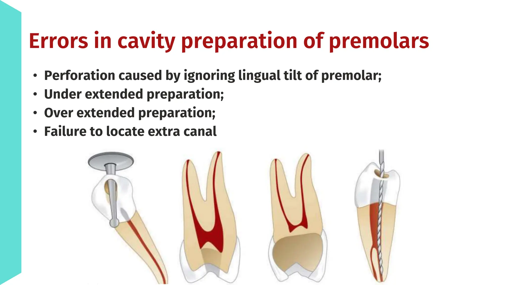 Principles of Access cavity preparation.pptx