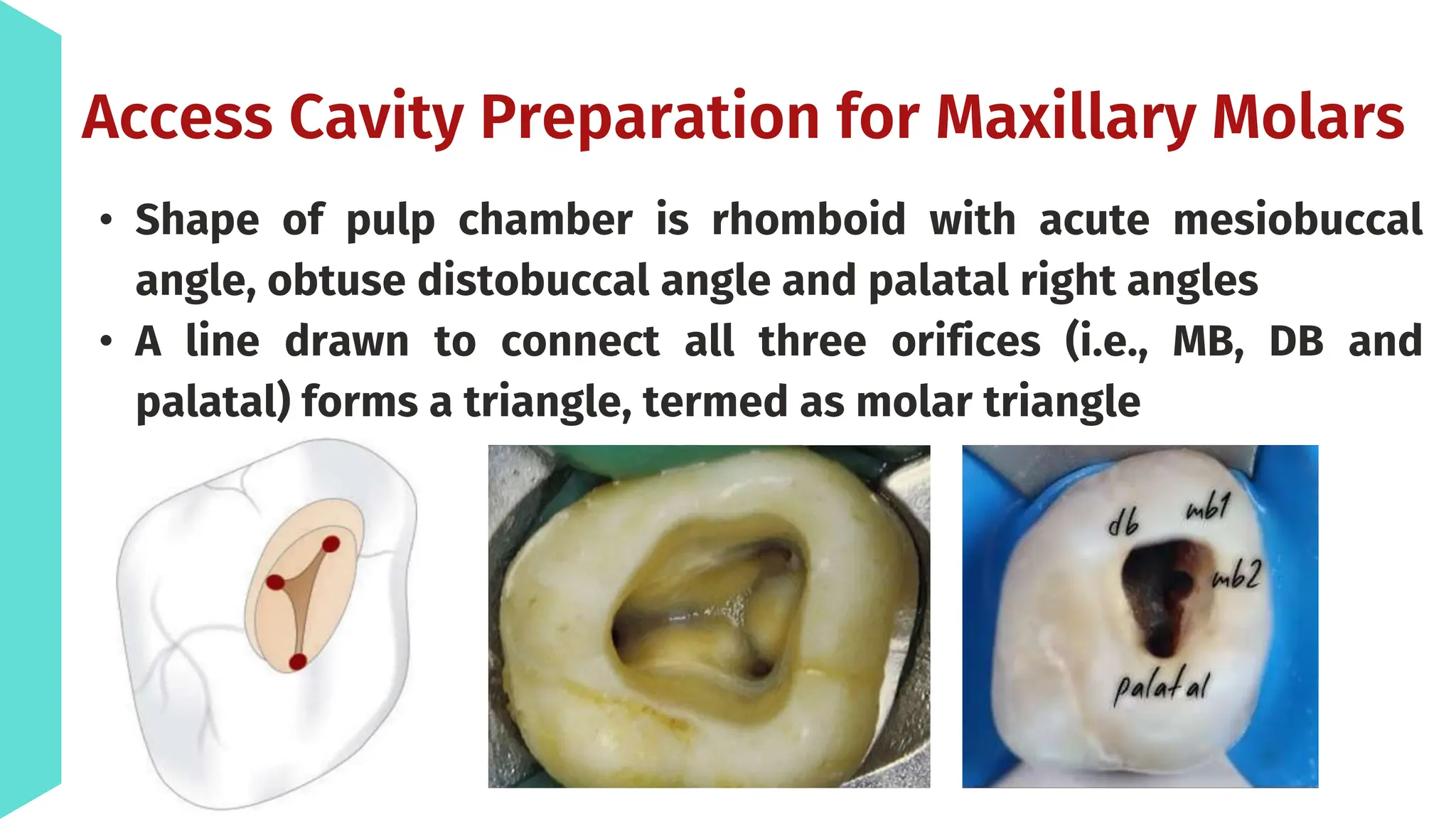 Principles of Access cavity preparation.pptx