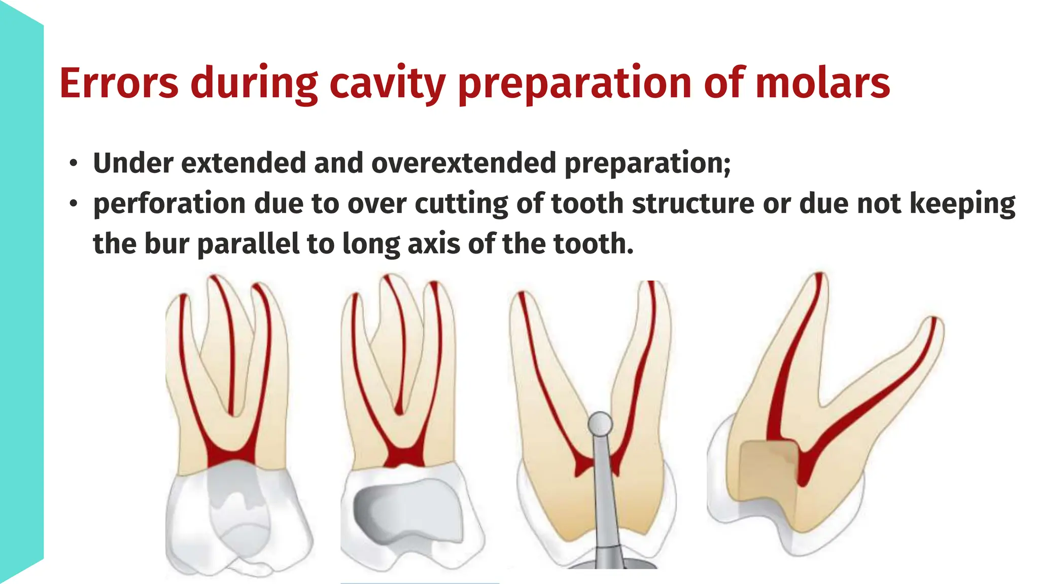 Principles of Access cavity preparation.pptx