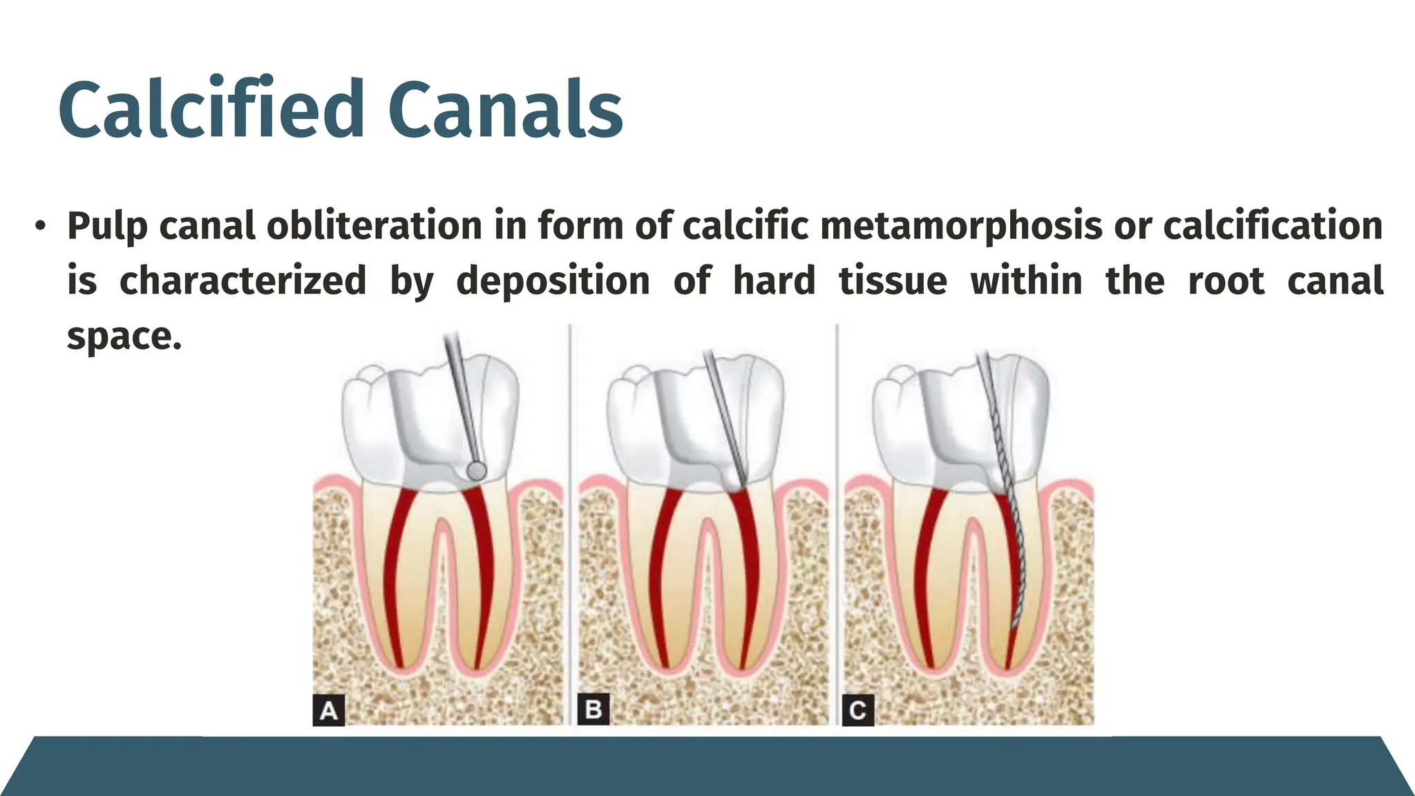 Principles of Access cavity preparation.pptx