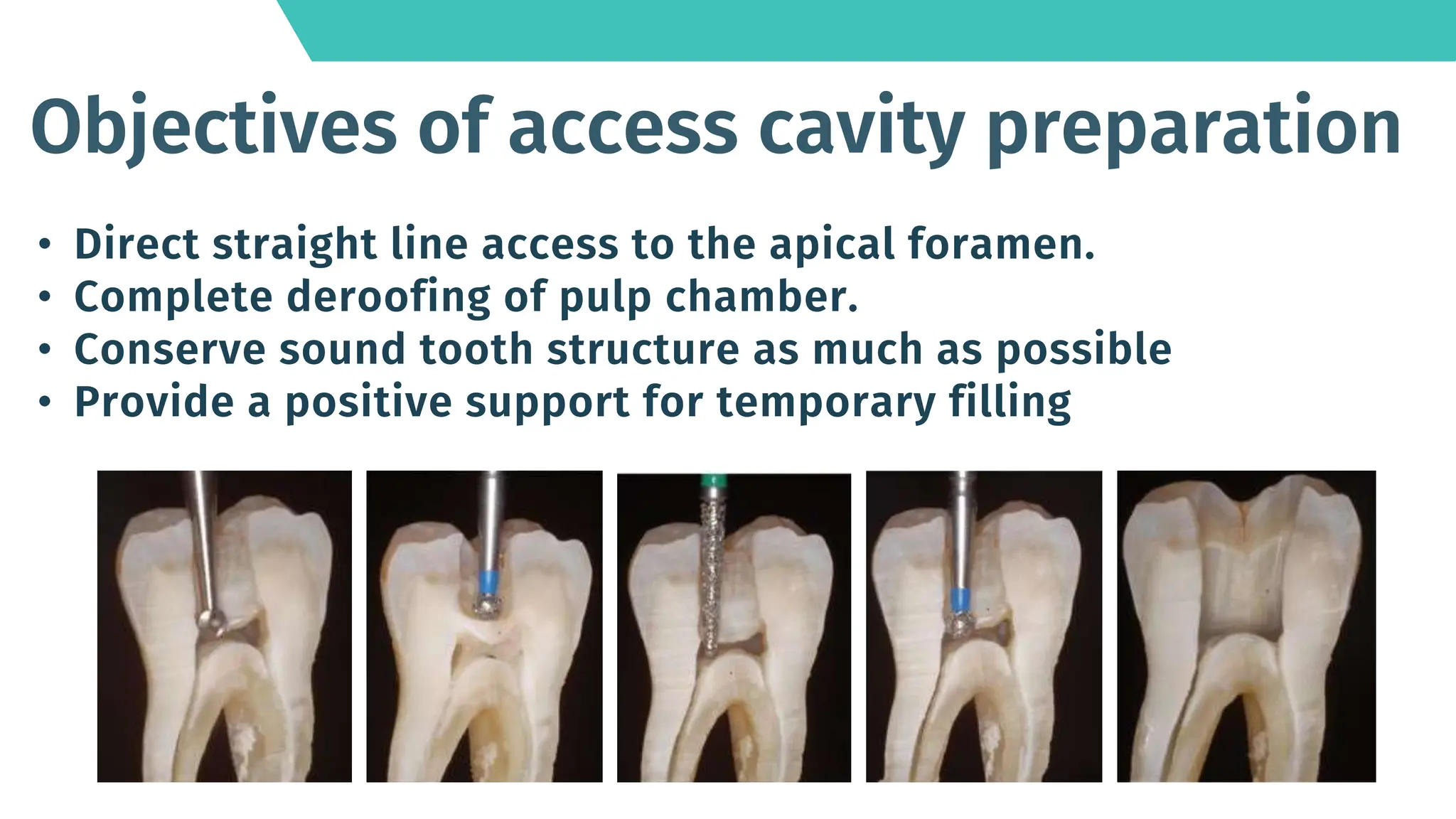 Principles of Access cavity preparation.pptx