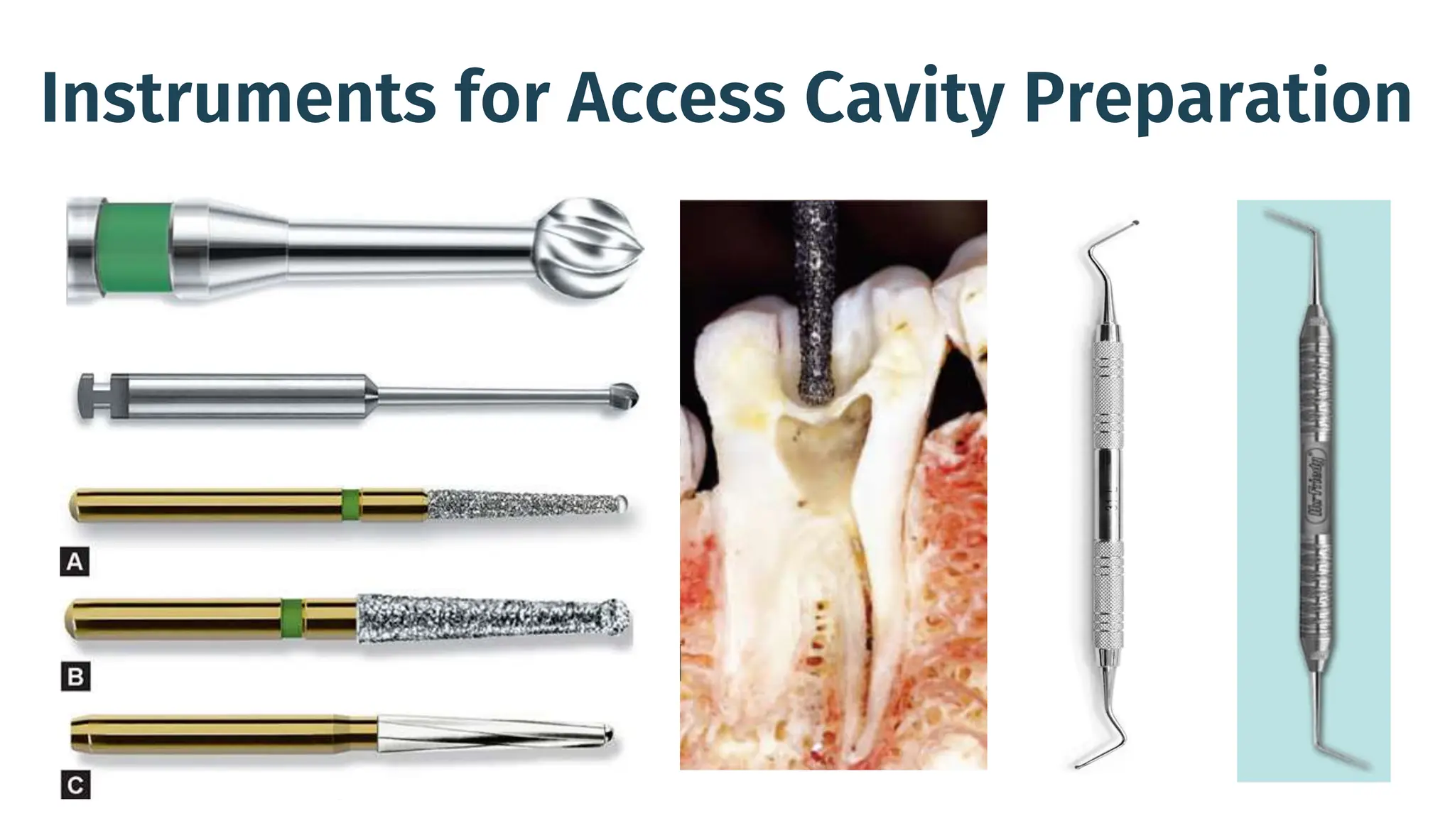 Principles of Access cavity preparation.pptx