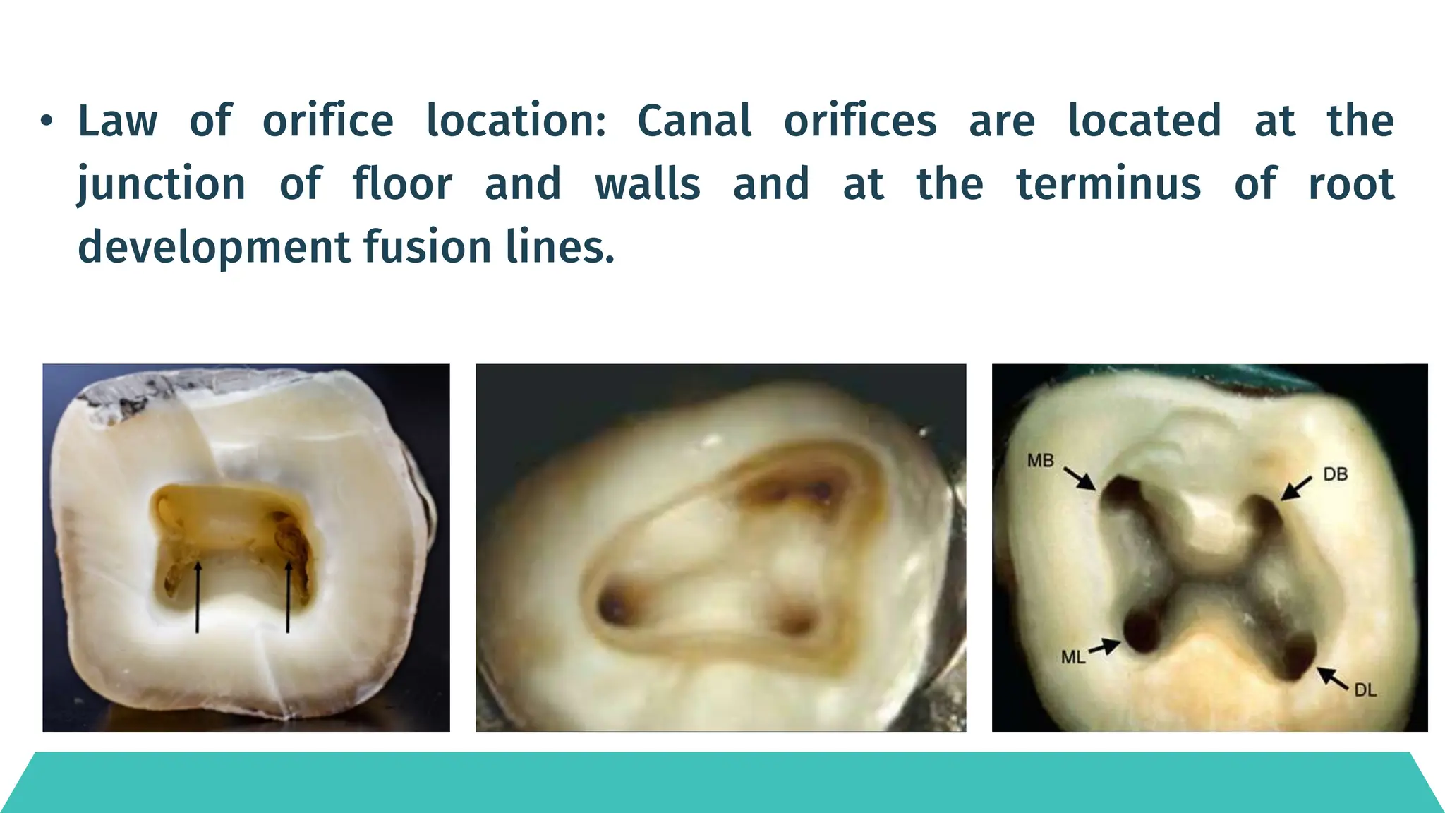 Principles of Access cavity preparation.pptx