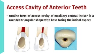 Principles of Access cavity preparation.pptx