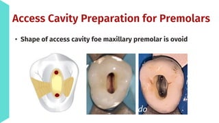 Principles of Access cavity preparation.pptx