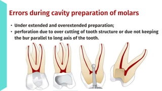 Principles of Access cavity preparation.pptx