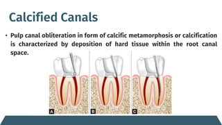 Principles of Access cavity preparation.pptx