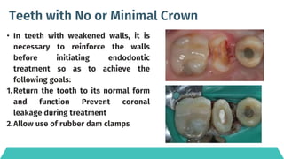 Principles of Access cavity preparation.pptx