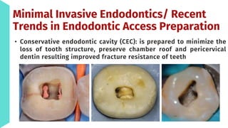 Principles of Access cavity preparation.pptx