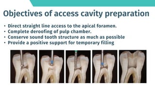 Principles of Access cavity preparation.pptx